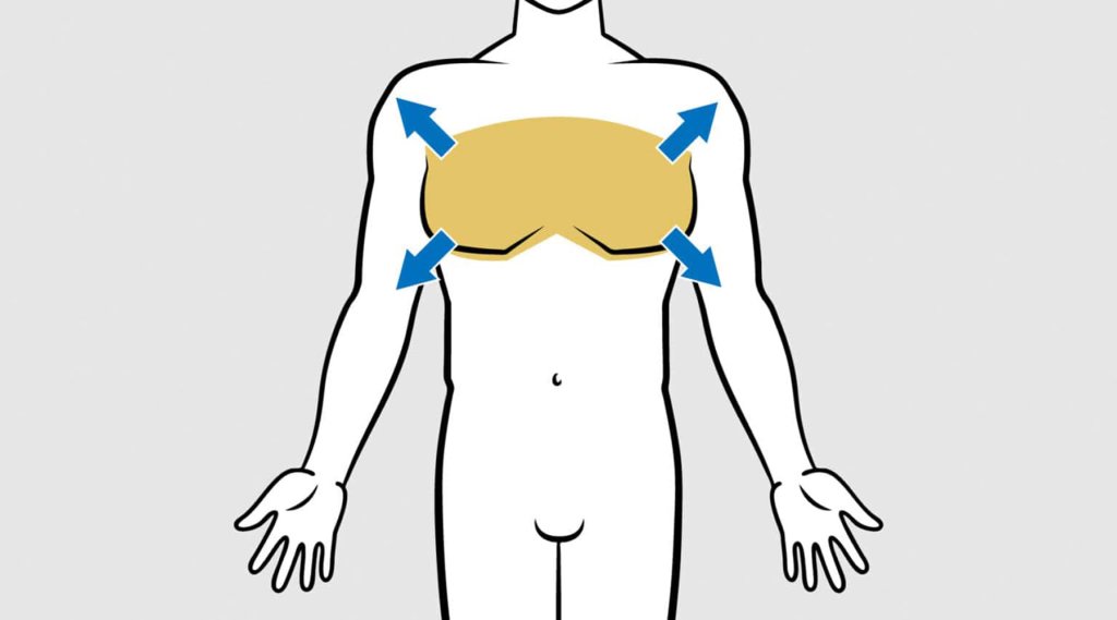 Chest Liposuction | Imagen Body Sculpting
