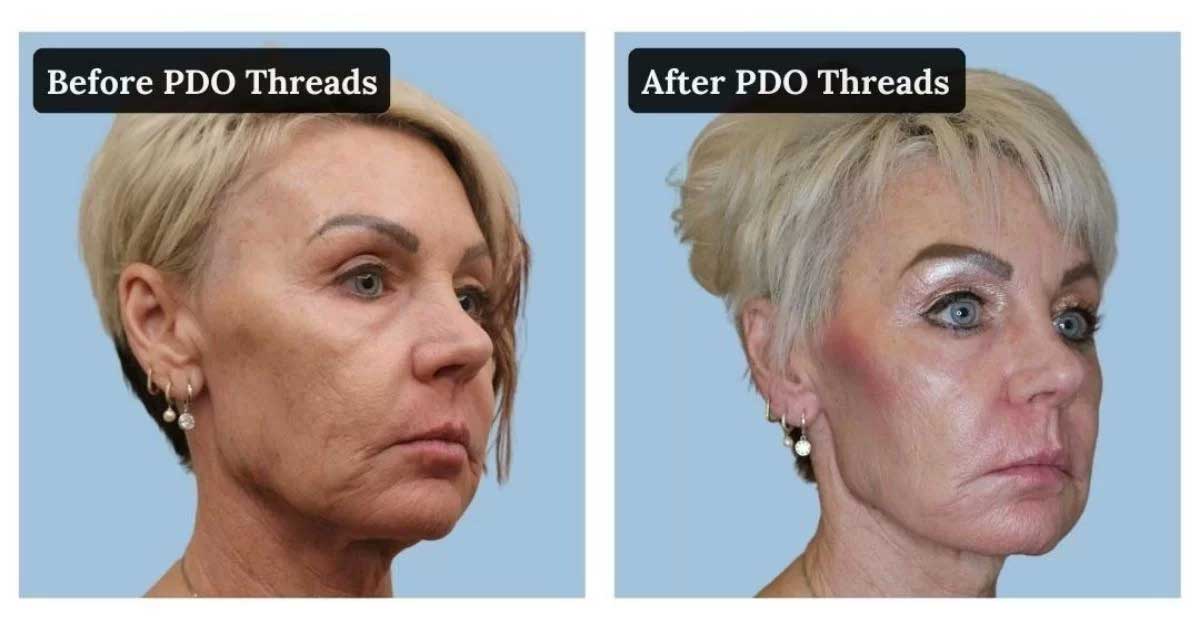 6 Reasons Why Your Jawline Isn’t Defined (& How To Get It) - Imagen ...